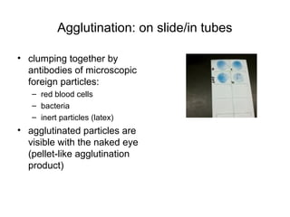 Immune tests in the laboratory diagnosis of infections | PPT ...