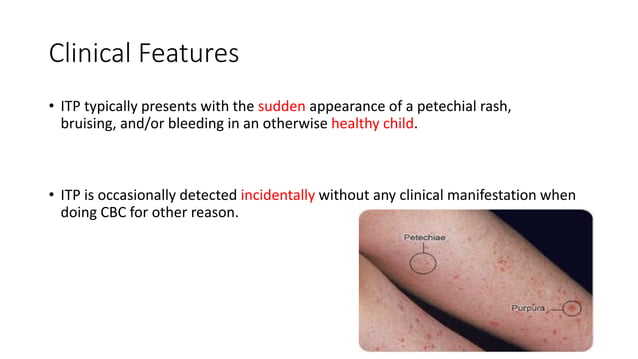 Immune Thrombocytopenia (ITP).pdf