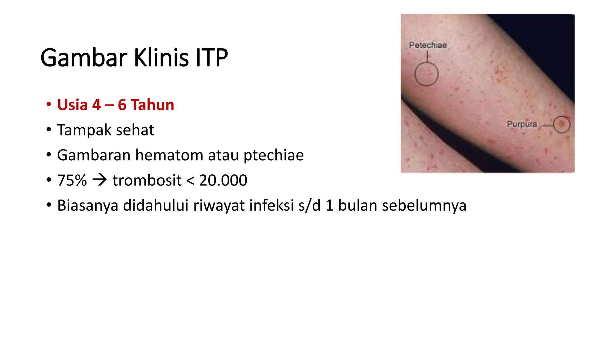 Immune Thrombocytopenic Purpura.pptx