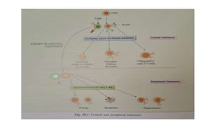 IMMUNE TOLERANCE 1.pptx