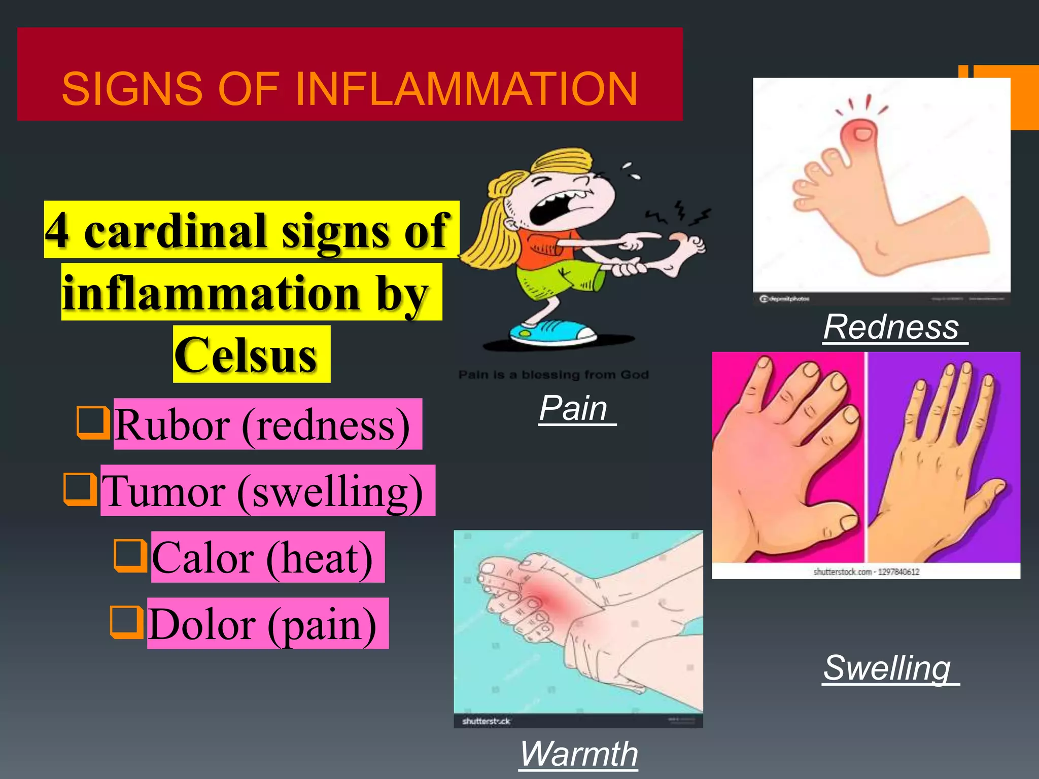 Immunity & Inflammation | PPTX