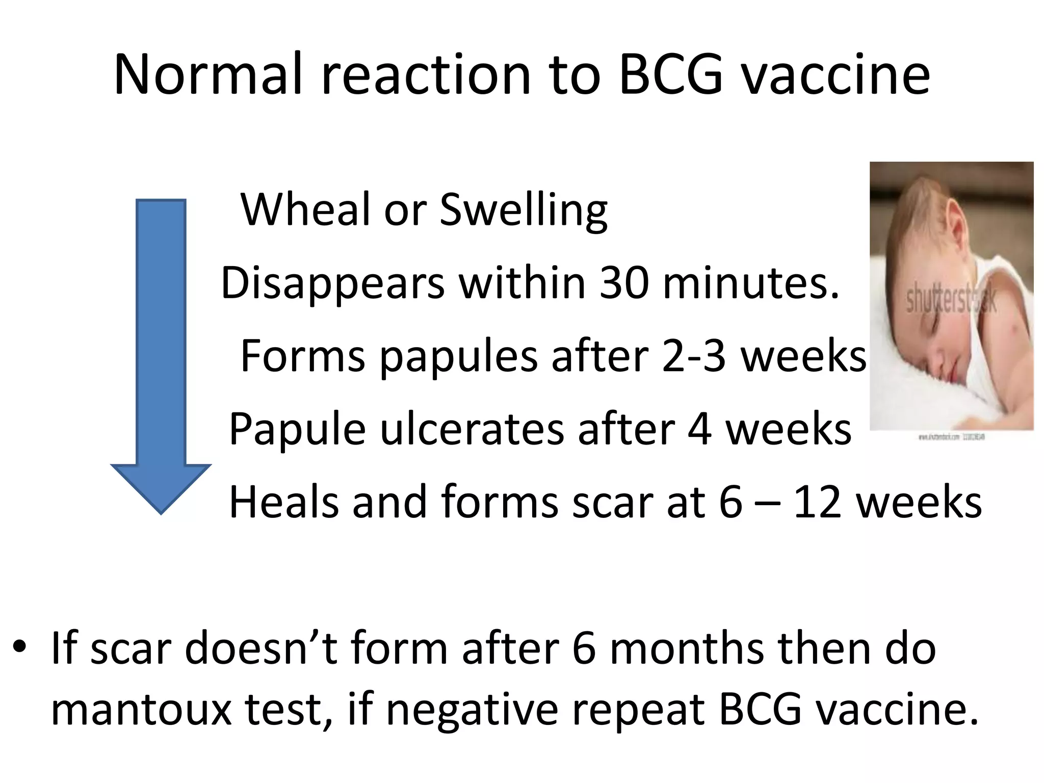 Vaccine and its types,sera,cold chain | PPTX