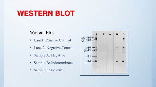 Western blot lyme test interpretation - kotixp