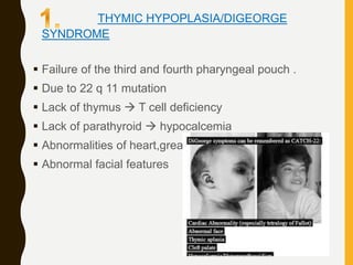 Immuno deficiency diseases- primary and secondary | PPTX