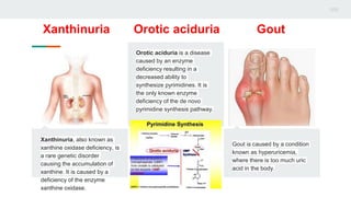 Immuno deficiency disorder Associated with purine metabolism | PPTX ...
