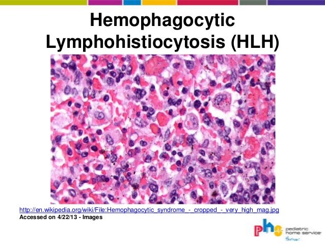 Immunodeficiency syndromes part 3