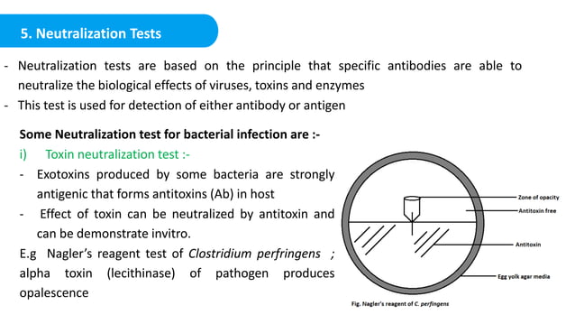 Immunodiagnostic methods for bacterial infection By Prabhat Dhakal ...