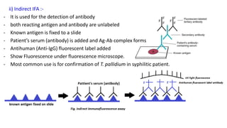 Immunodiagnostic methods for bacterial infection By Prabhat Dhakal | PPT
