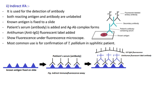 Immunodiagnostic methods for bacterial infection By Prabhat Dhakal ...