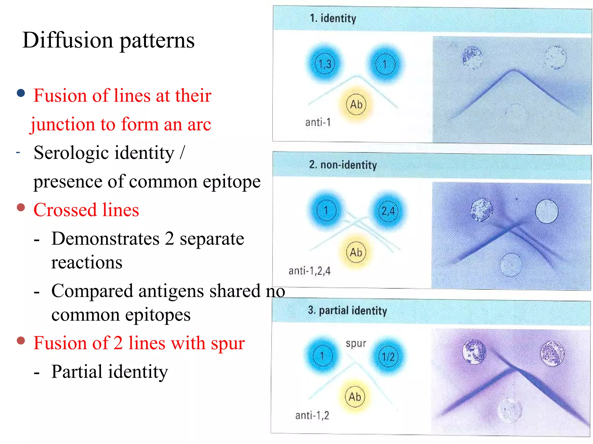 Immunodiffusion principles and application | PPT