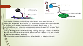 Immunoelectron microscopy | PPTX