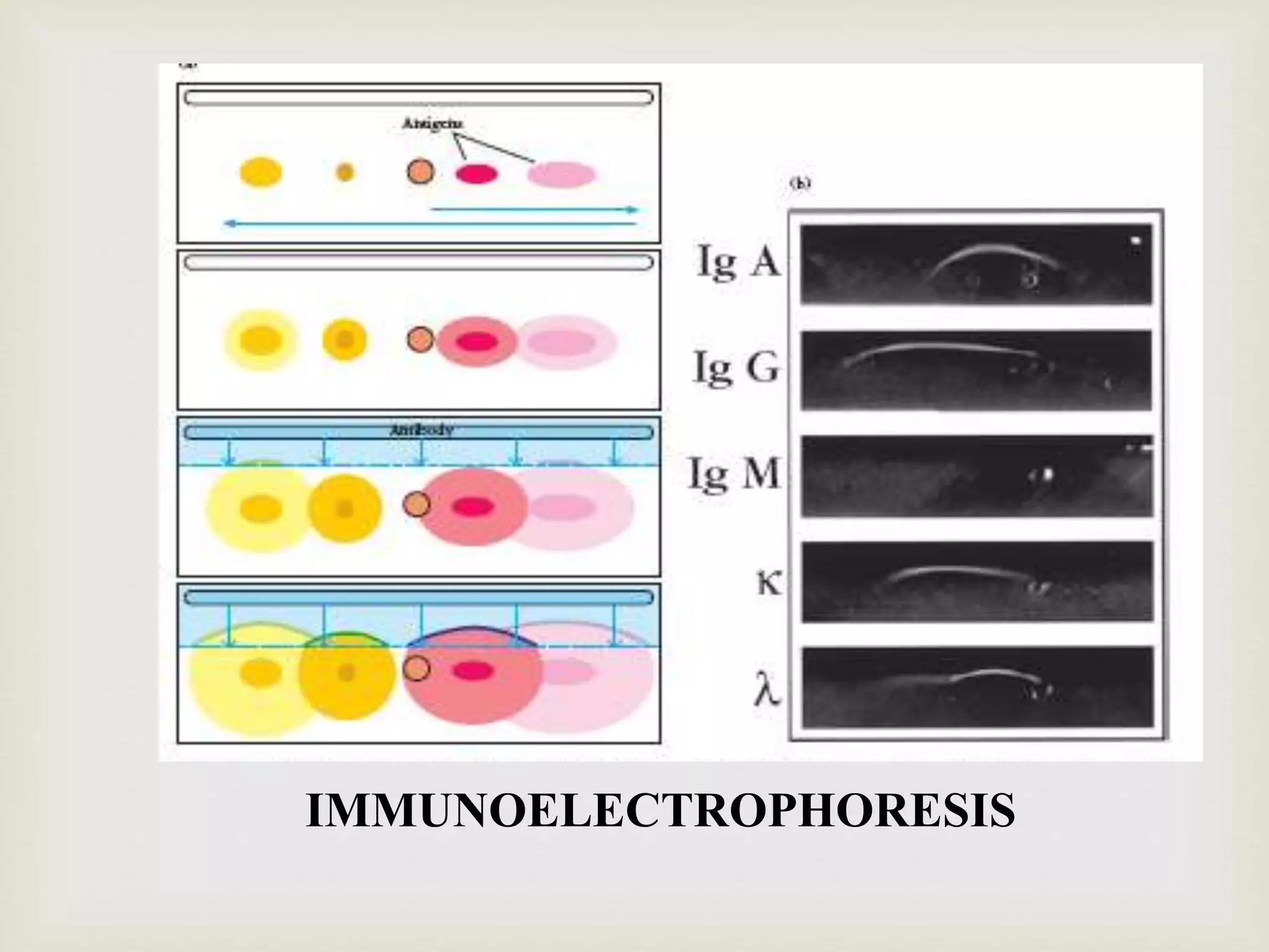 Immunoelectrophoresis | PPTX