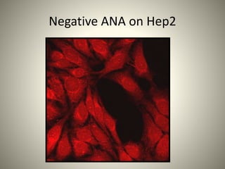 Immunofluorescence 130125142023-phpapp02 | PPTX