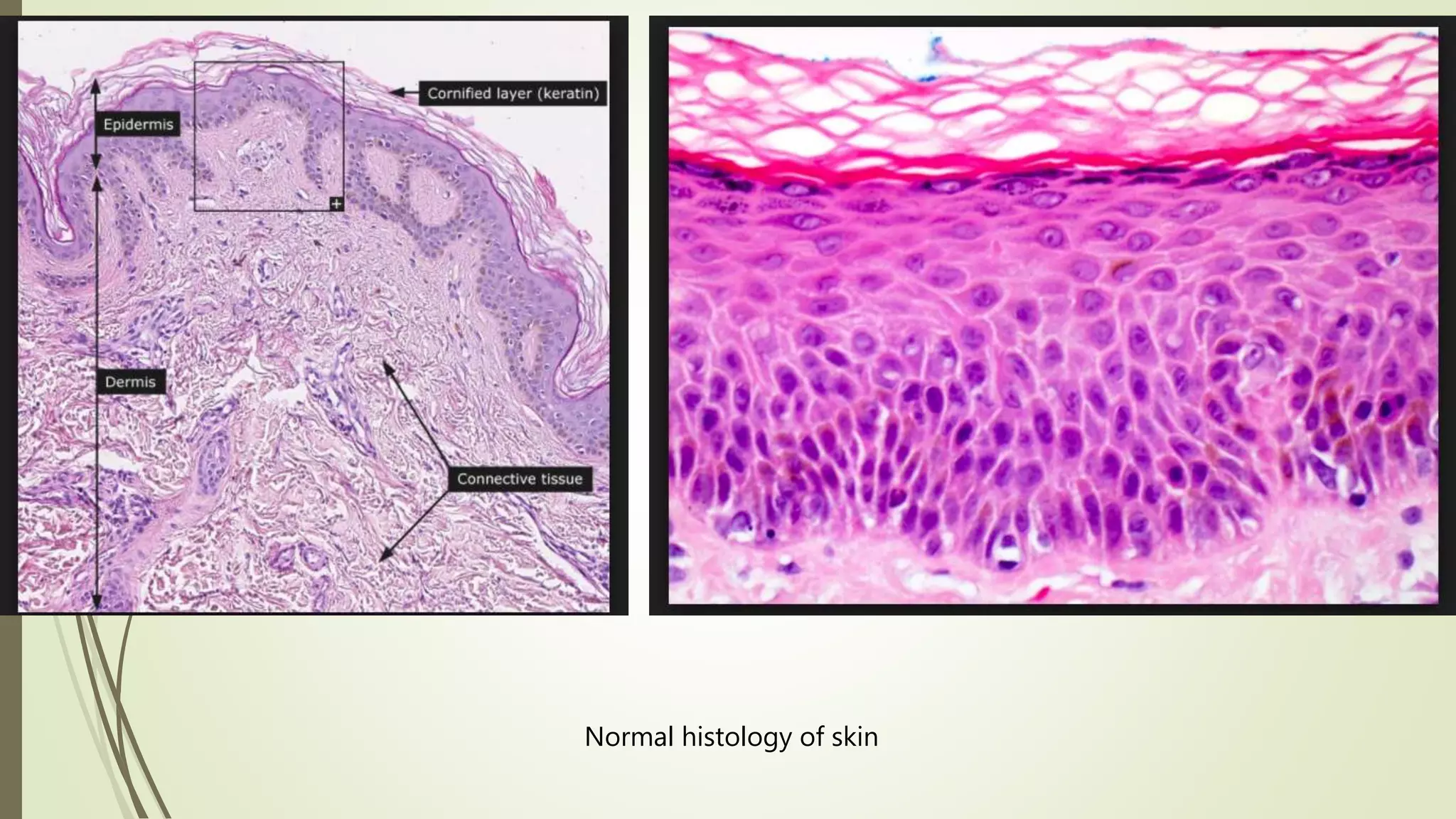 Immunofluorescence in dermatopathology | PPTX