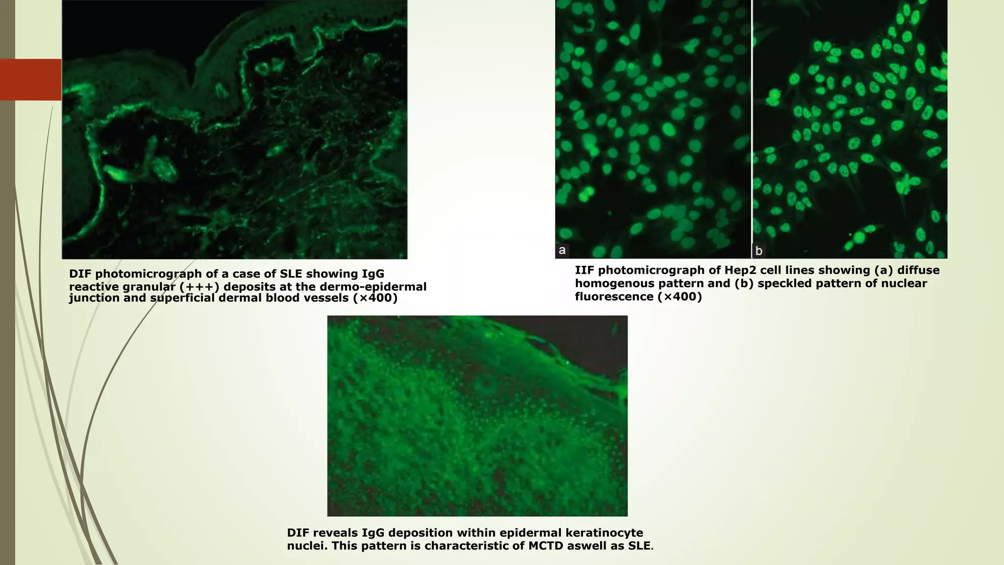 Immunofluorescence in dermatopathology | PPTX