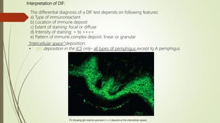 Immunofluorescence in dermatopathology | PPTX