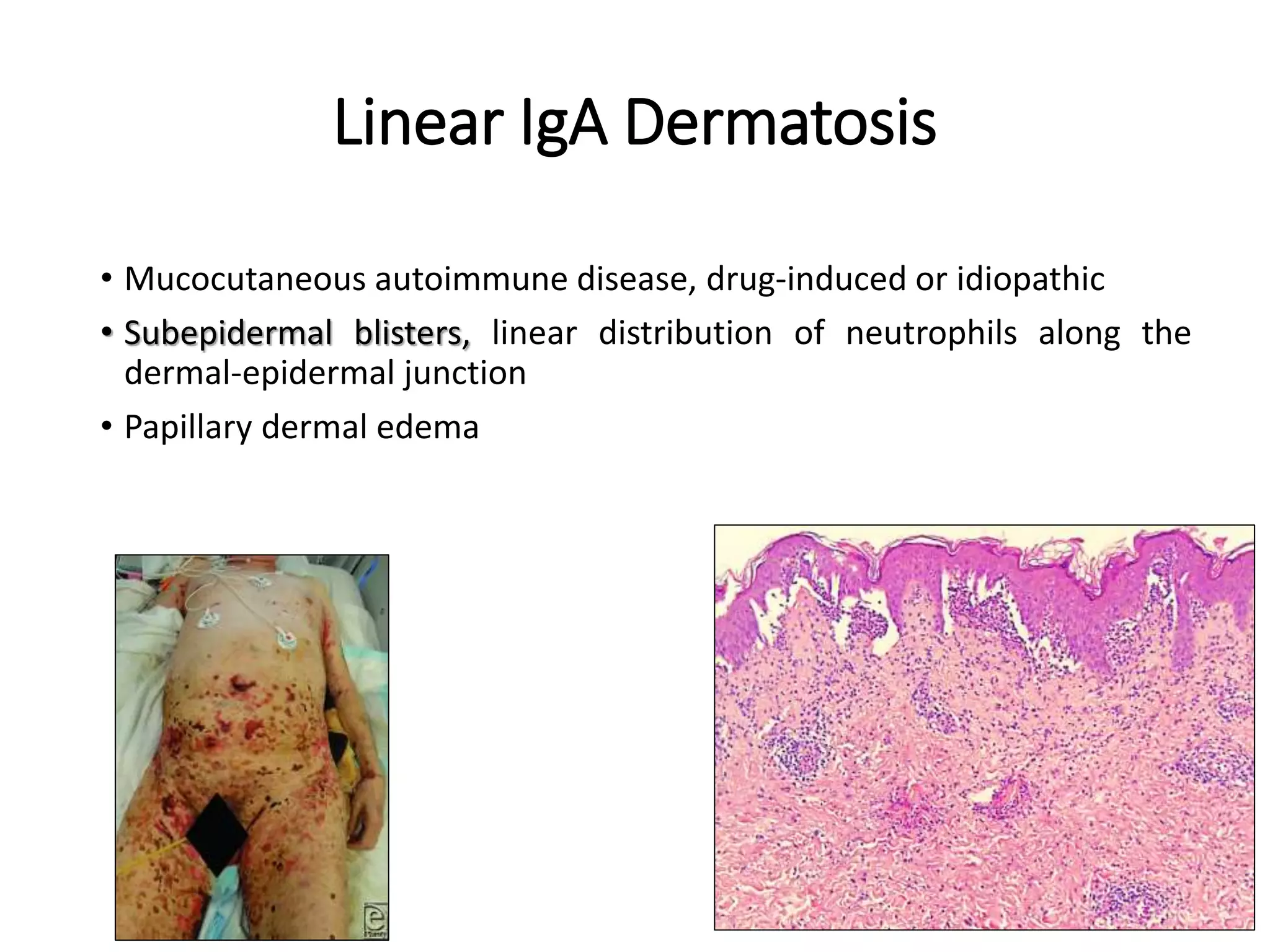 Immunofluorescence and its role in histopathology | PPTX