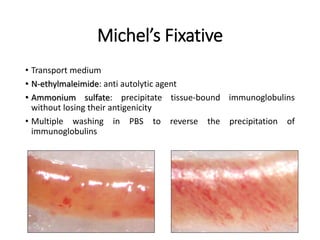 Immunofluorescence and its role in histopathology | PPTX