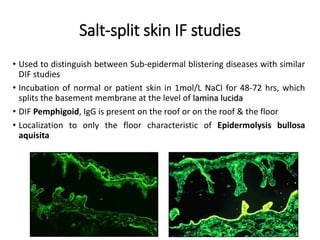 Immunofluorescence and its role in histopathology | PPTX