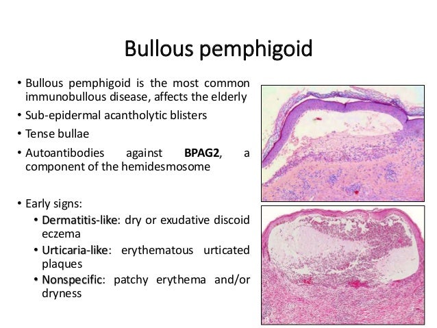 Immunofluorescence and its role in histopathology