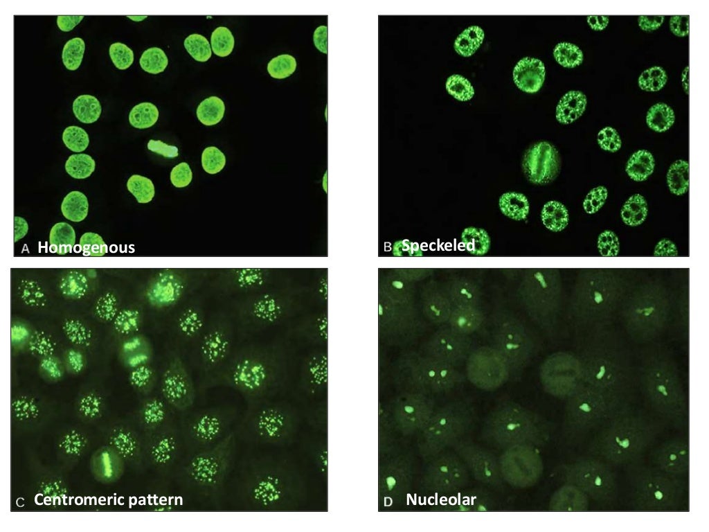 Immunofluorescence and its role in histopathology