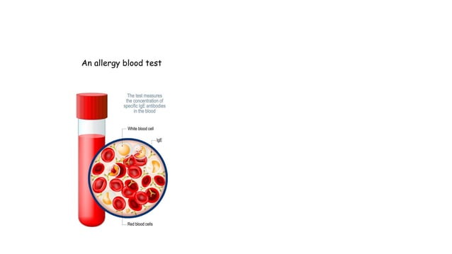Immunoglobulins and ELISA.pdf Chapter -1 Preparation | PDF