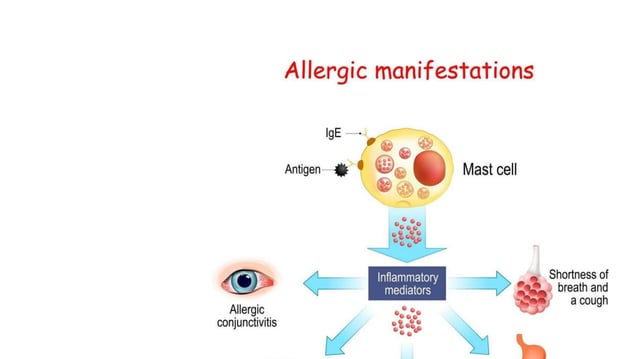 Immunoglobulins and ELISA.pdf Chapter -1 Preparation | PDF