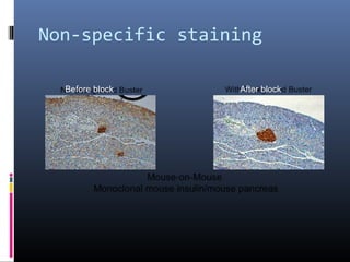 Immunohistochemistry | PPT