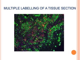 Immunohistochemistry | PPT