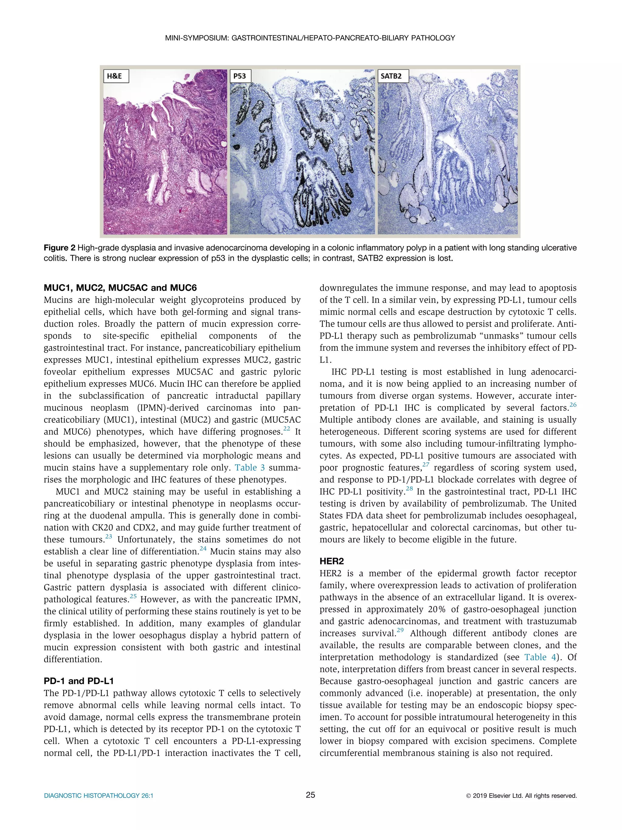 Immunohistochemistry and special stains in gastrointestinal pathology ...