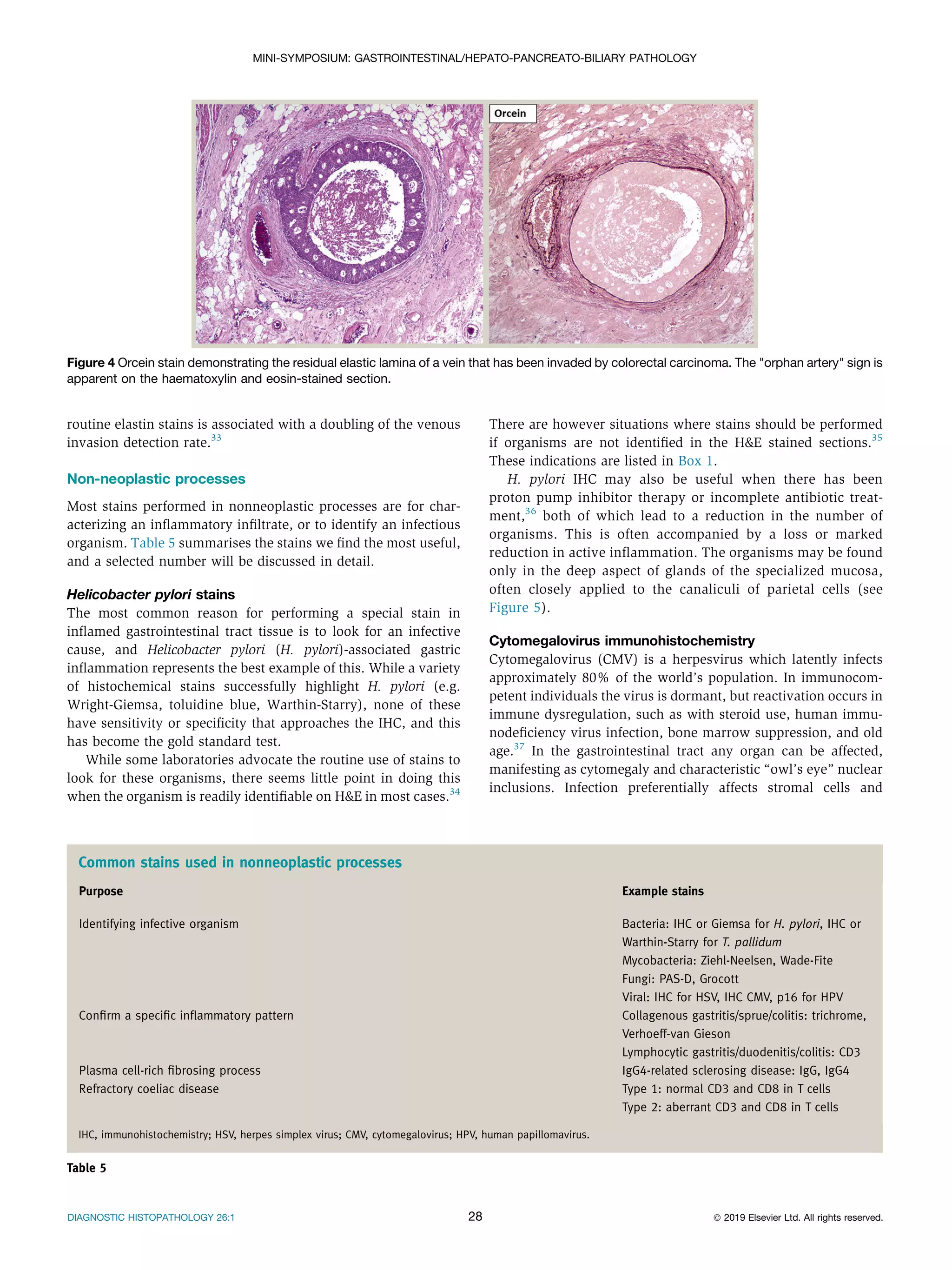 Immunohistochemistry and special stains in gastrointestinal pathology ...