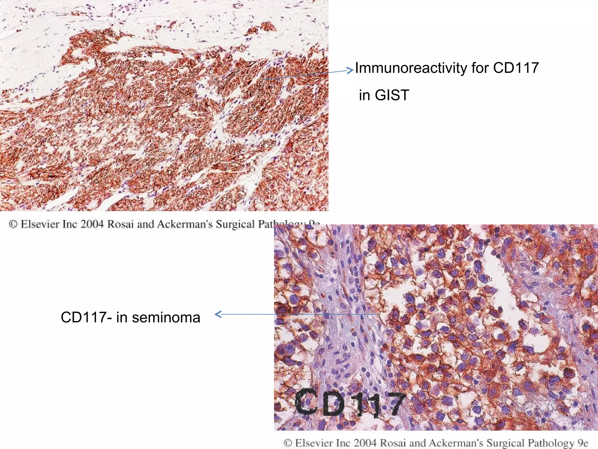 Immunohistochemistry | PPT