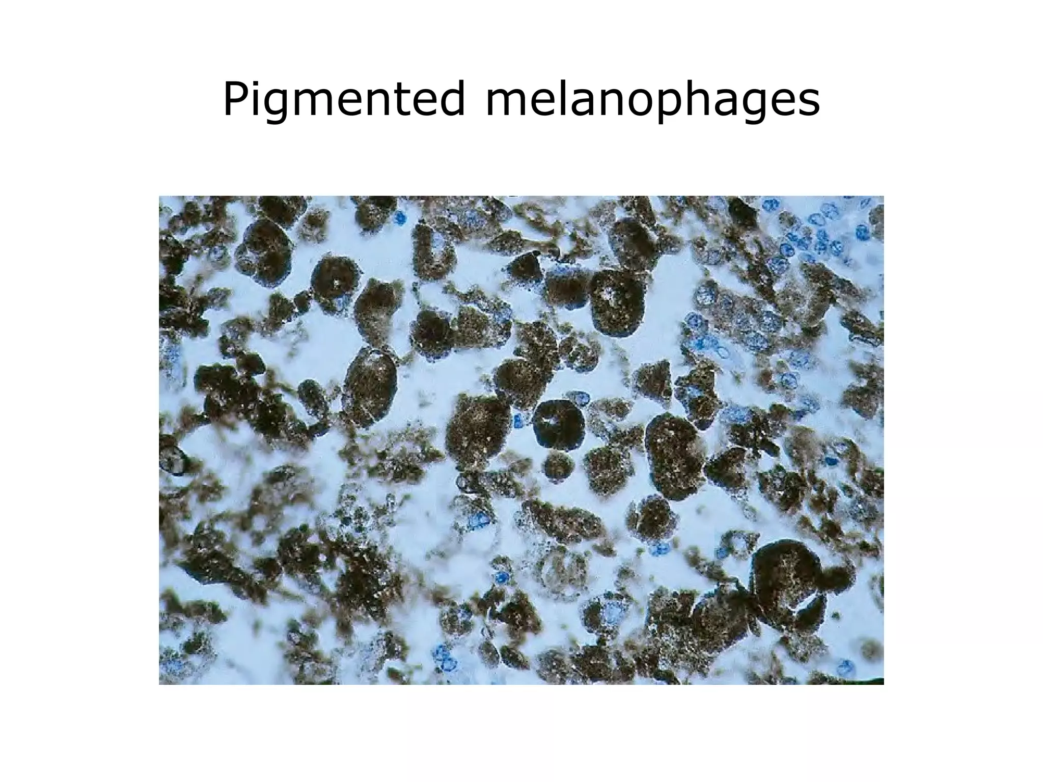 Immunohistochemistry | PPT