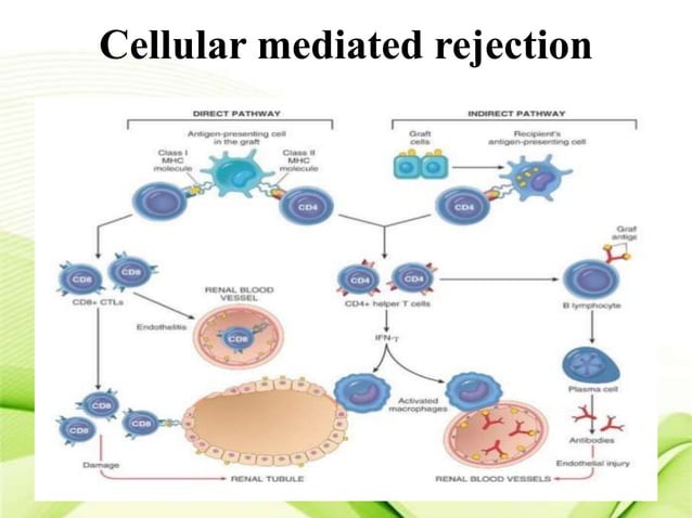 Immunological basis of graft rejection and mechanism of graft rejection