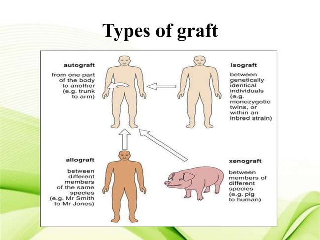 Immunological basis of graft rejection and mechanism of graft rejection