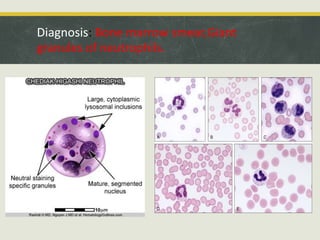 Immunological disorder | PPTX