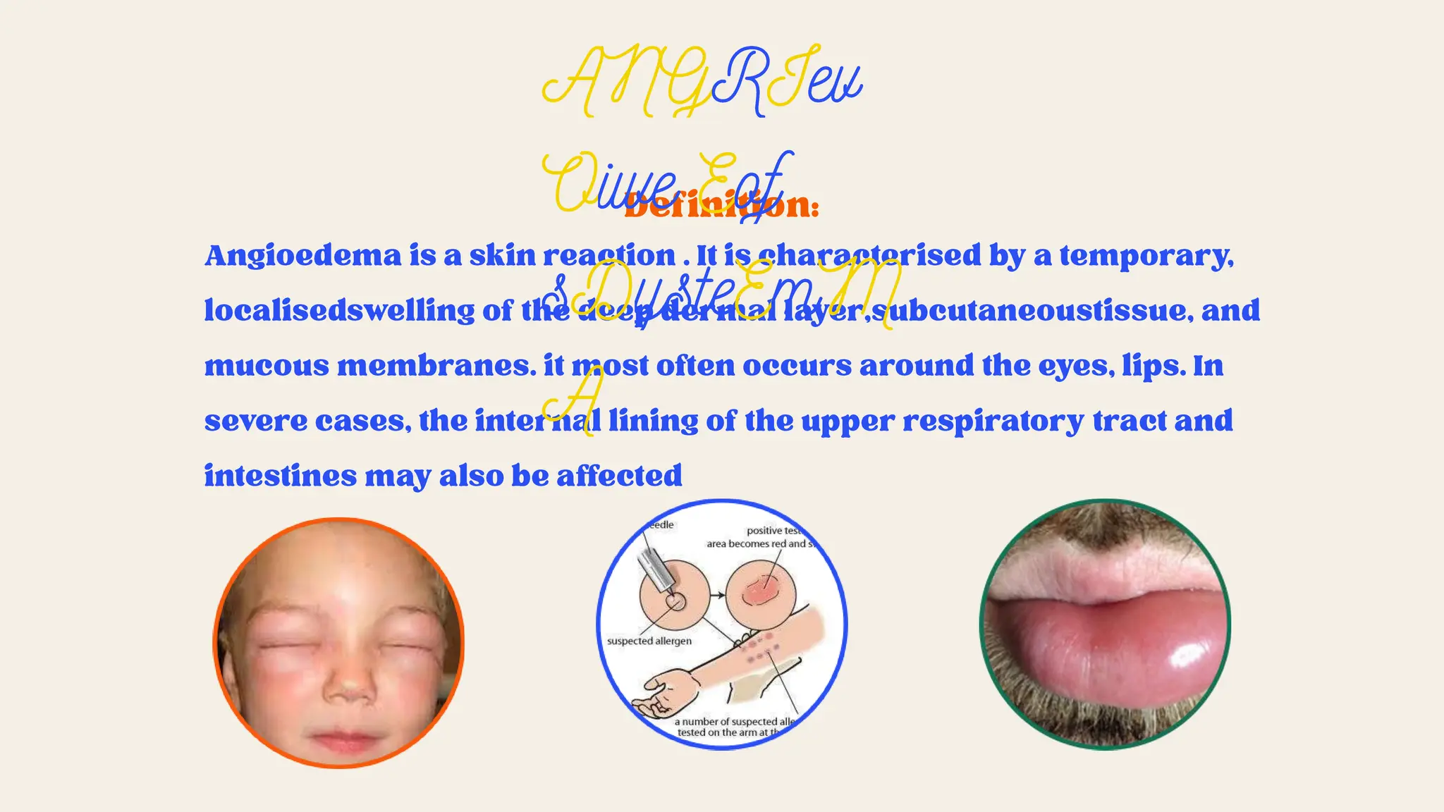 Immunological Disorders diagnosis using ROS.pdf.pptx