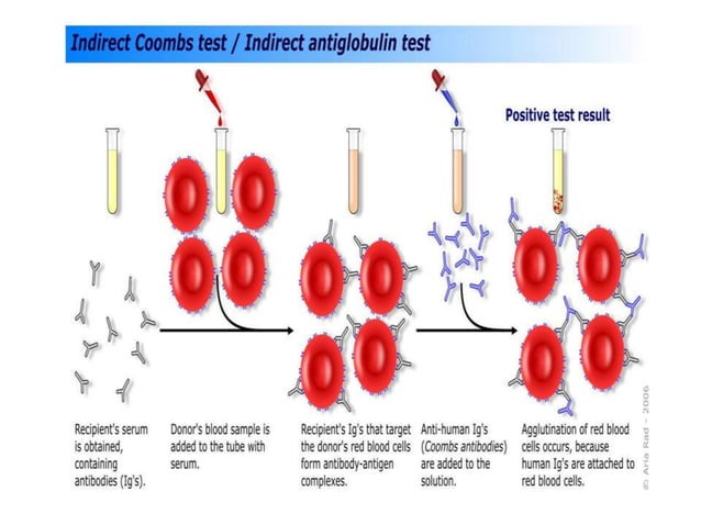 Immunological techniques | PPTX | Blood Disorders | Diseases and Conditions