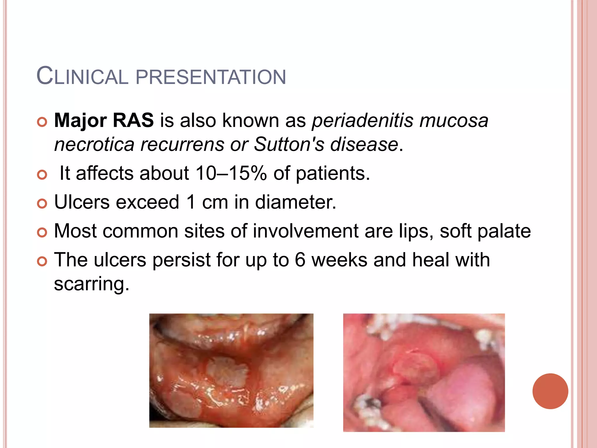 Immunologic diseses of oral cavity | PPTX