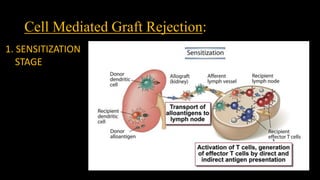Immunological Basis of Graft Rejection | PPTX