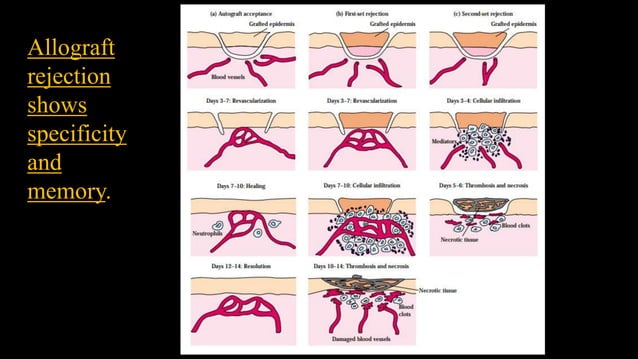 Immunological Basis of Graft Rejection | PPTX | Genetics | Science