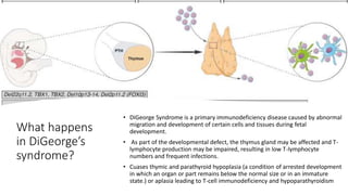 DiGeogressyndrome.pptx