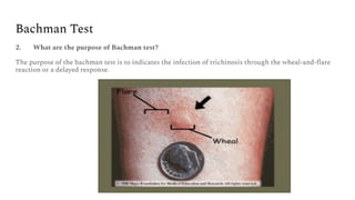 Immunology-Report-Group-1.pdf (Bachman test) | PDF