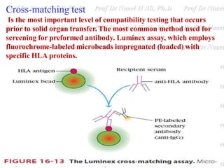 Immunology of Transplantation 23.pdf