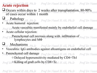 Immunology of transplantation .pp Immunology of transplantationst | PPT