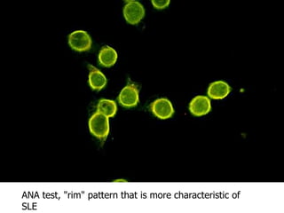 -immunopathology-2.ppt