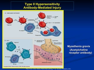 Immunopathology lecture 2+3 ,final | PPT