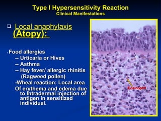 Immunopathology lecture 2+3 ,final | PPT | Allergies | Diseases and ...