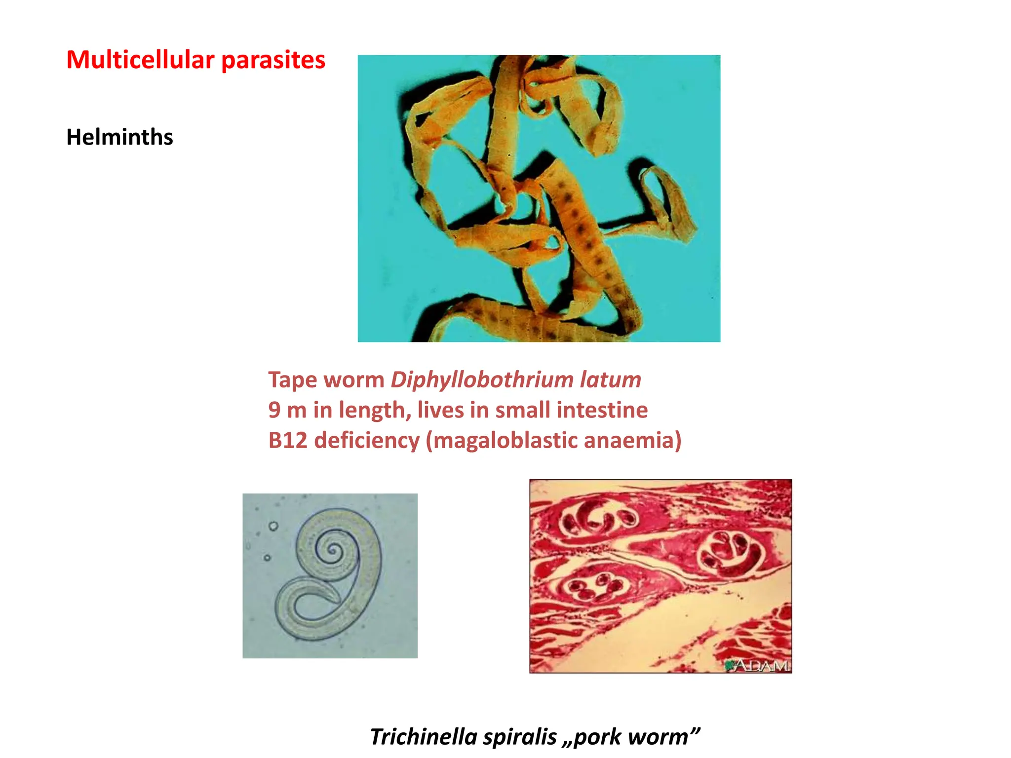 immunopathology of parasitc infections for mph 2016 set.ppt