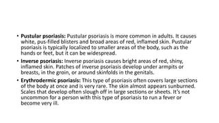 Immunopathology of psoriasis | PPTX